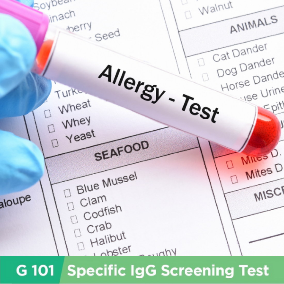Allergy IgG Test (G101 items) - Discover Your Hidden Allergies: IgG ...